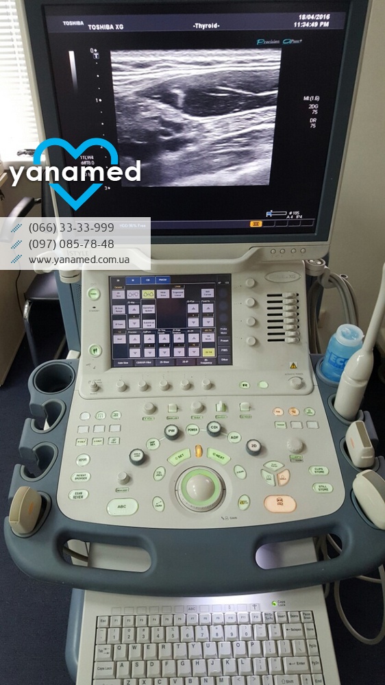 Купити УЗД апарат Toshiba Aplio XG 2010 в Україні | Янамед